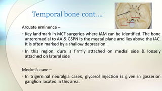 Anatomy temporal bone | PDF