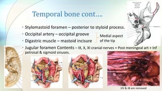 Anatomy temporal bone | PDF