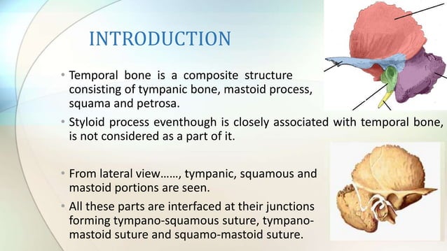 Anatomy temporal bone | PDF | Death, Injury, or Military Conflict ...