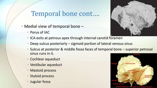 Anatomy of temporal bone | PPTX