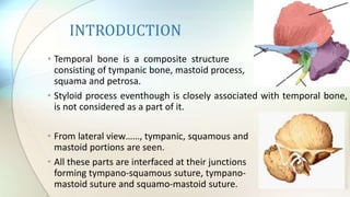 Anatomy of temporal bone | PPTX