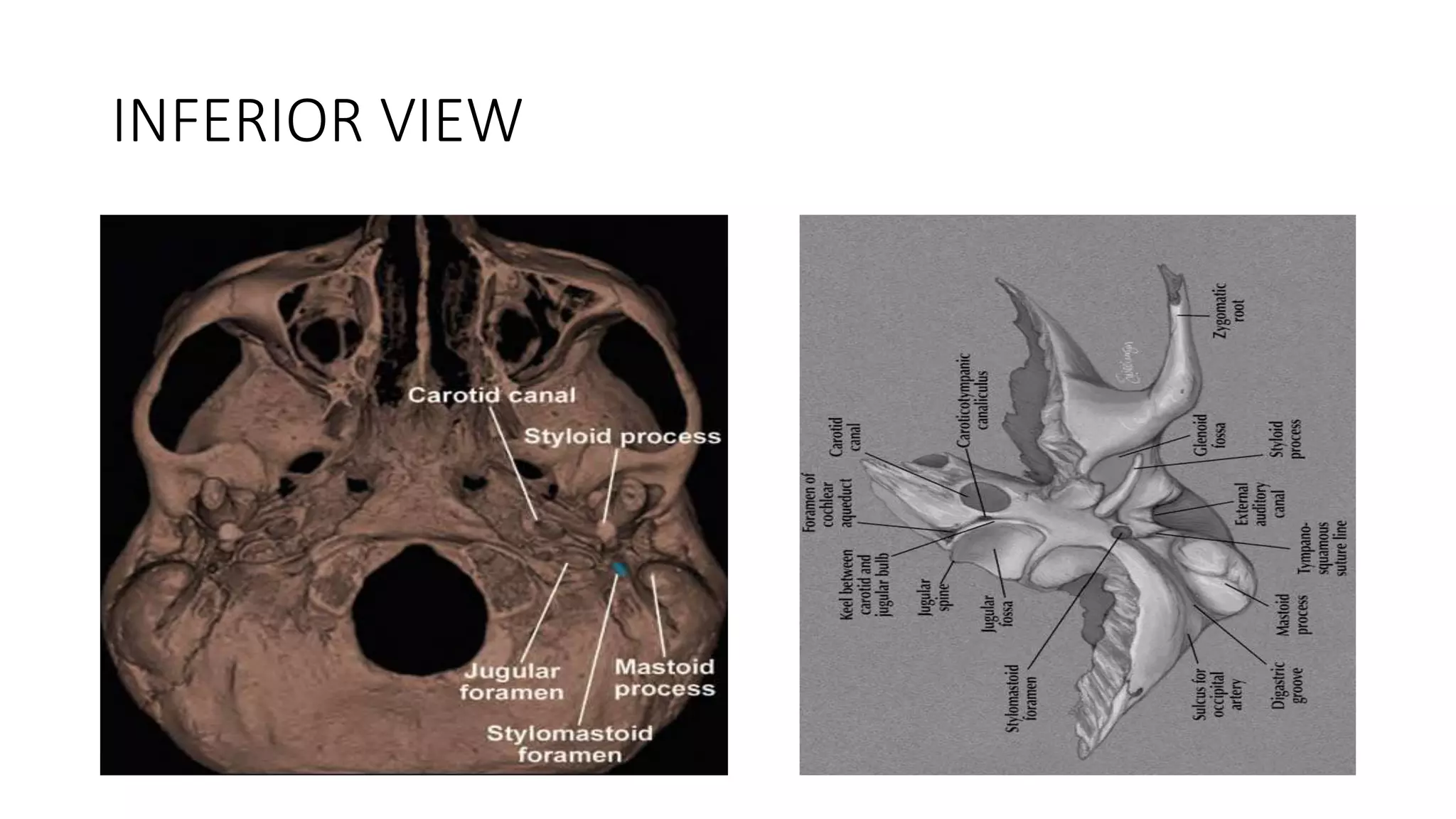 Anatomy temporal bone | PPTX