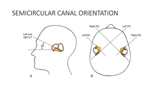 Anatomy temporal bone | PPTX