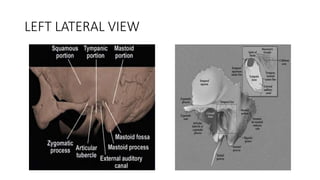 Anatomy temporal bone | PPTX