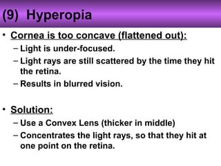 Anatomy Unit 1 Notes: Vision | PPT