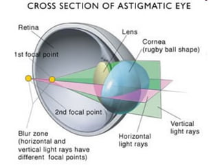 Anatomy Unit 1 Notes: Vision | PPT
