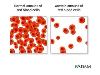 Anatomy Unit 2 Notes: Blood Composition | PPT