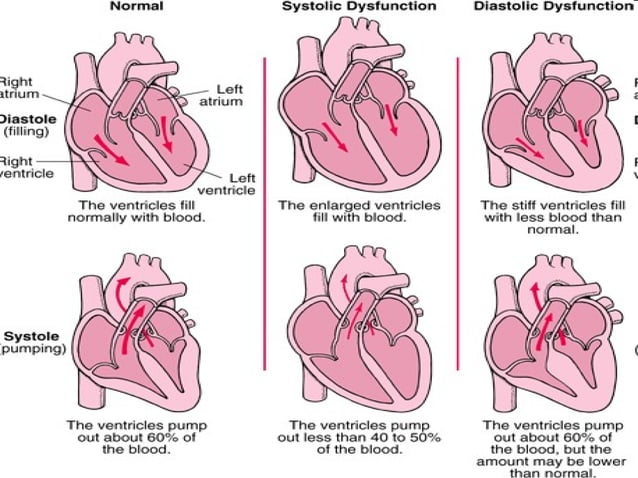 Anatomy Unit 2: Cardiac Conduction Notes | PPT