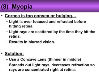 Anatomy unit 2 nervous system vision notes | PPT