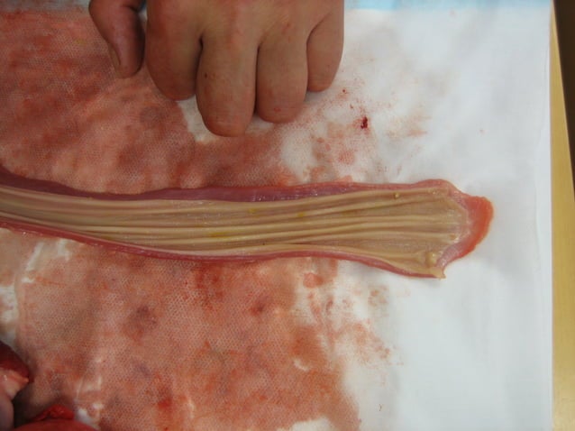 Anatomy Unit 3 Notes: Digestion Basics, The Mouth and The Esophagus ...