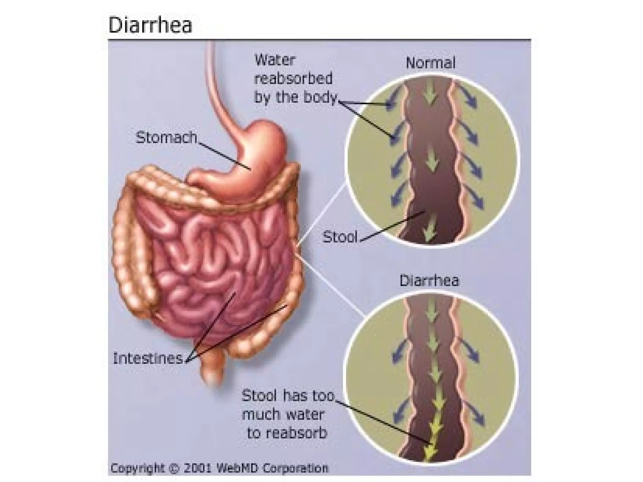 Anatomy Unit 3 Notes: The Large Intestine & Digestive Disorders | PPT