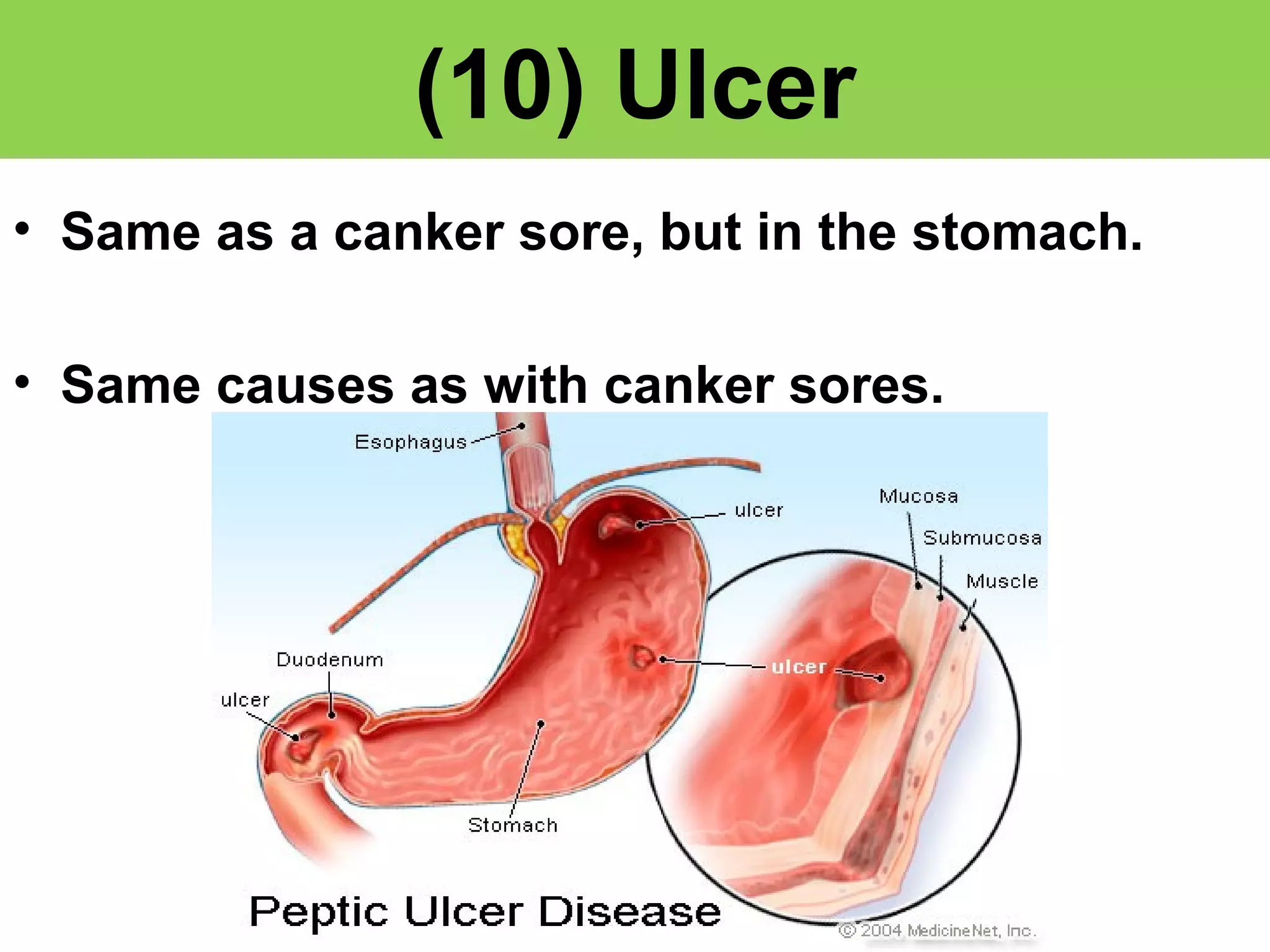 Anatomy Unit 3 Notes: The Large Intestine & Digestive Disorders | PPT