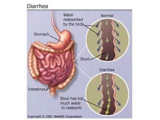 Anatomy Unit 3 Notes: The Large Intestine & Digestive Disorders | PPT ...