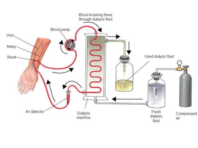 Anatomy unit 4 digestive and excretory systems excretory notes | PPT