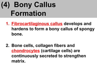 Anatomy Unit 4 Notes: Bone Repair | PPT