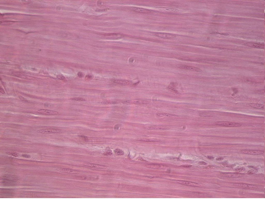 Anatomy Unit 4 Notes: Muscle Types & Parts