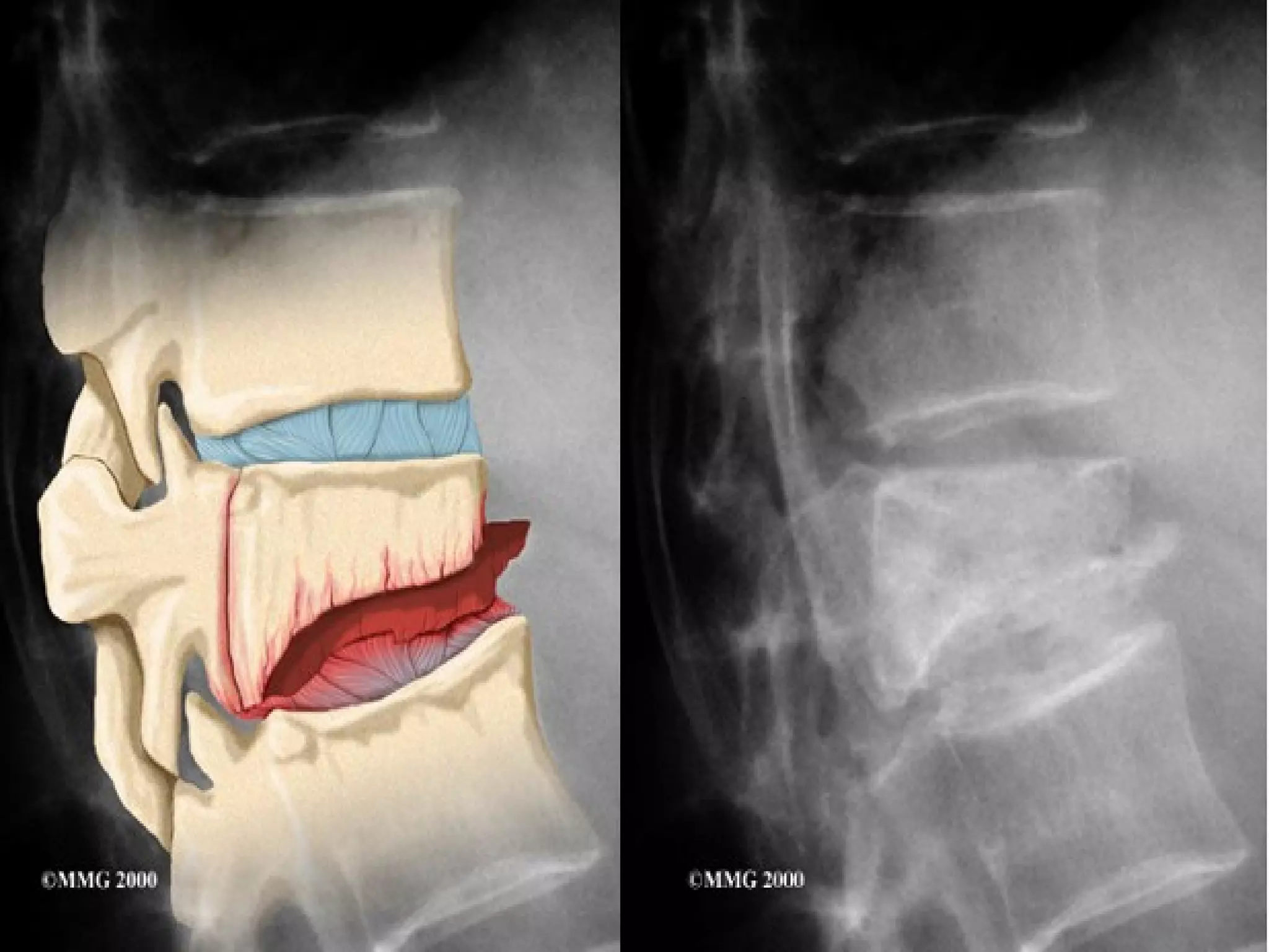 Anatomy unit 5 skeletal and muscular systems bone injury and repair ...