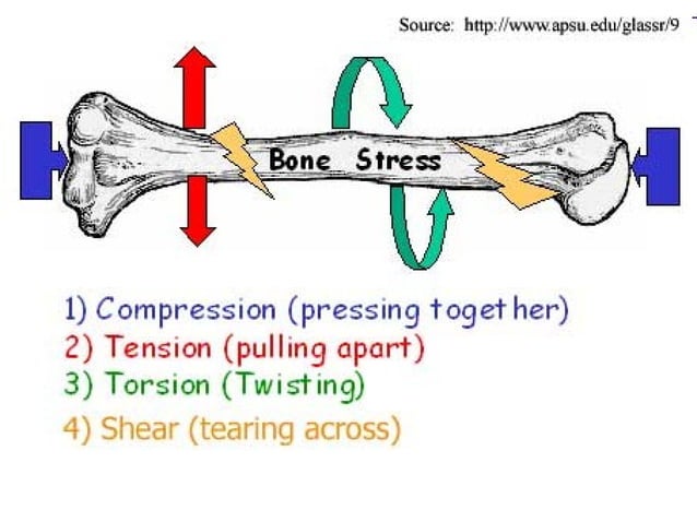 Anatomy unit 5 skeletal and muscular systems bone injury and repair ...