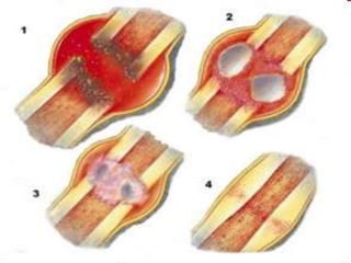 Anatomy unit 5 skeletal and muscular systems bone repair notes | PPT