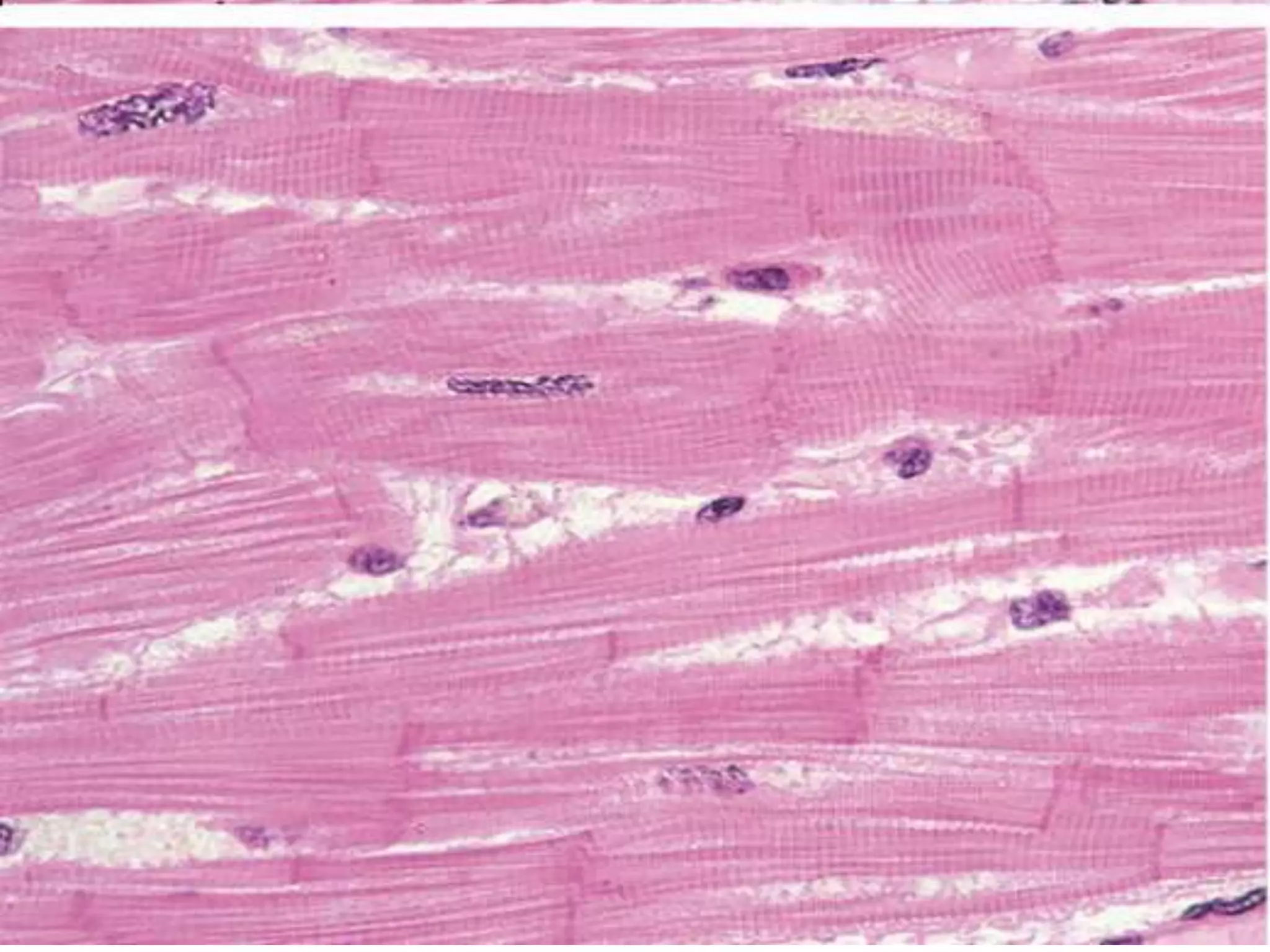 Anatomy unit 5 skeletal and muscular systems muscle types notes | PPT