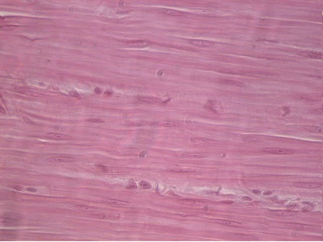 Anatomy unit 5 skeletal and muscular systems muscle types notes | PPT