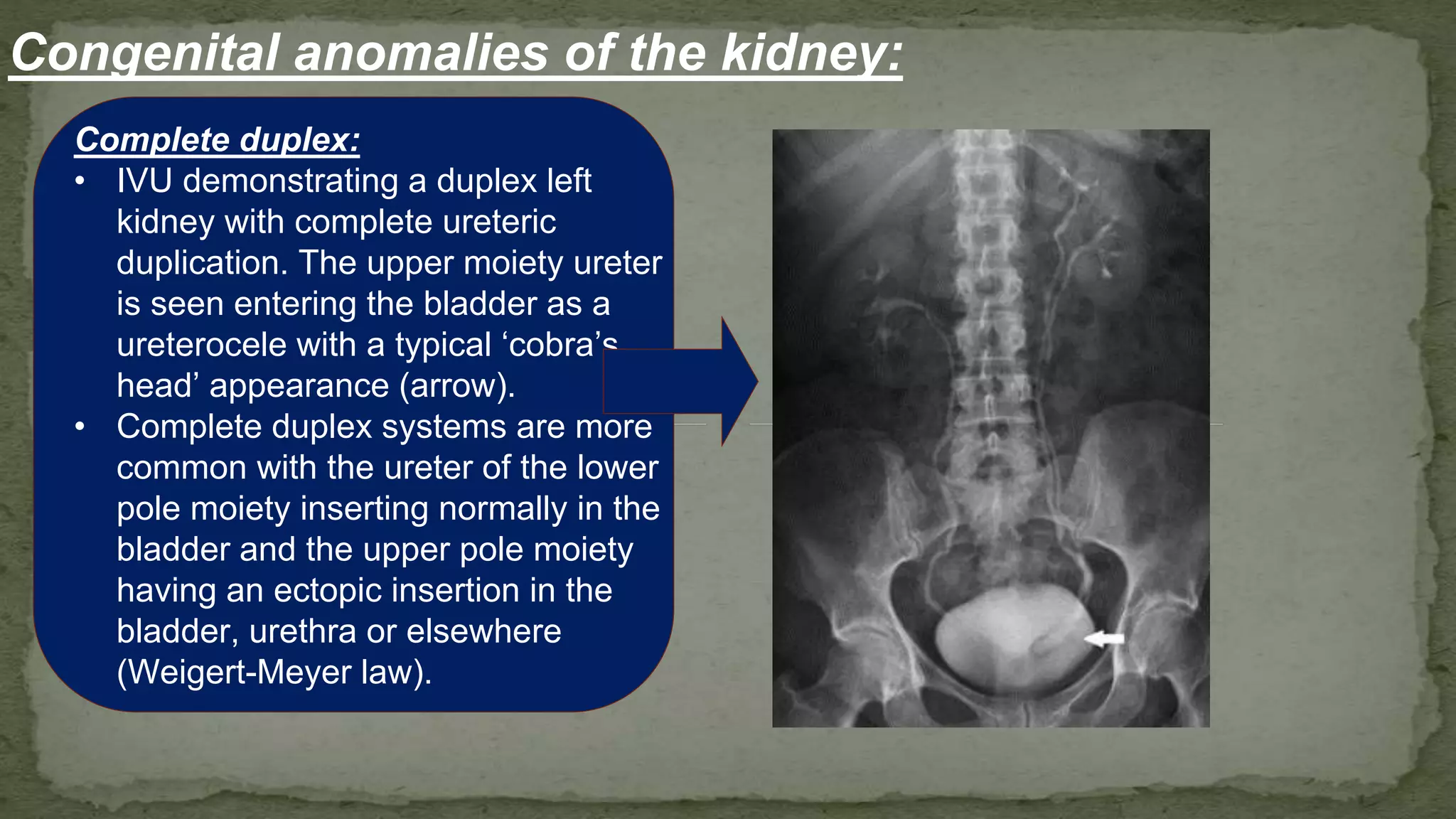 anatomy urinary system.pptx