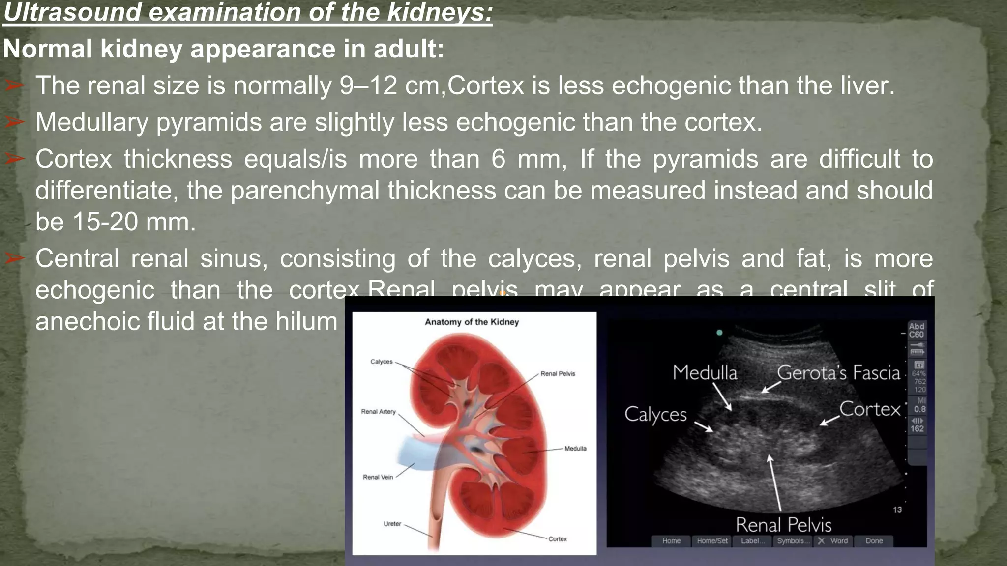 anatomy urinary system.pptx