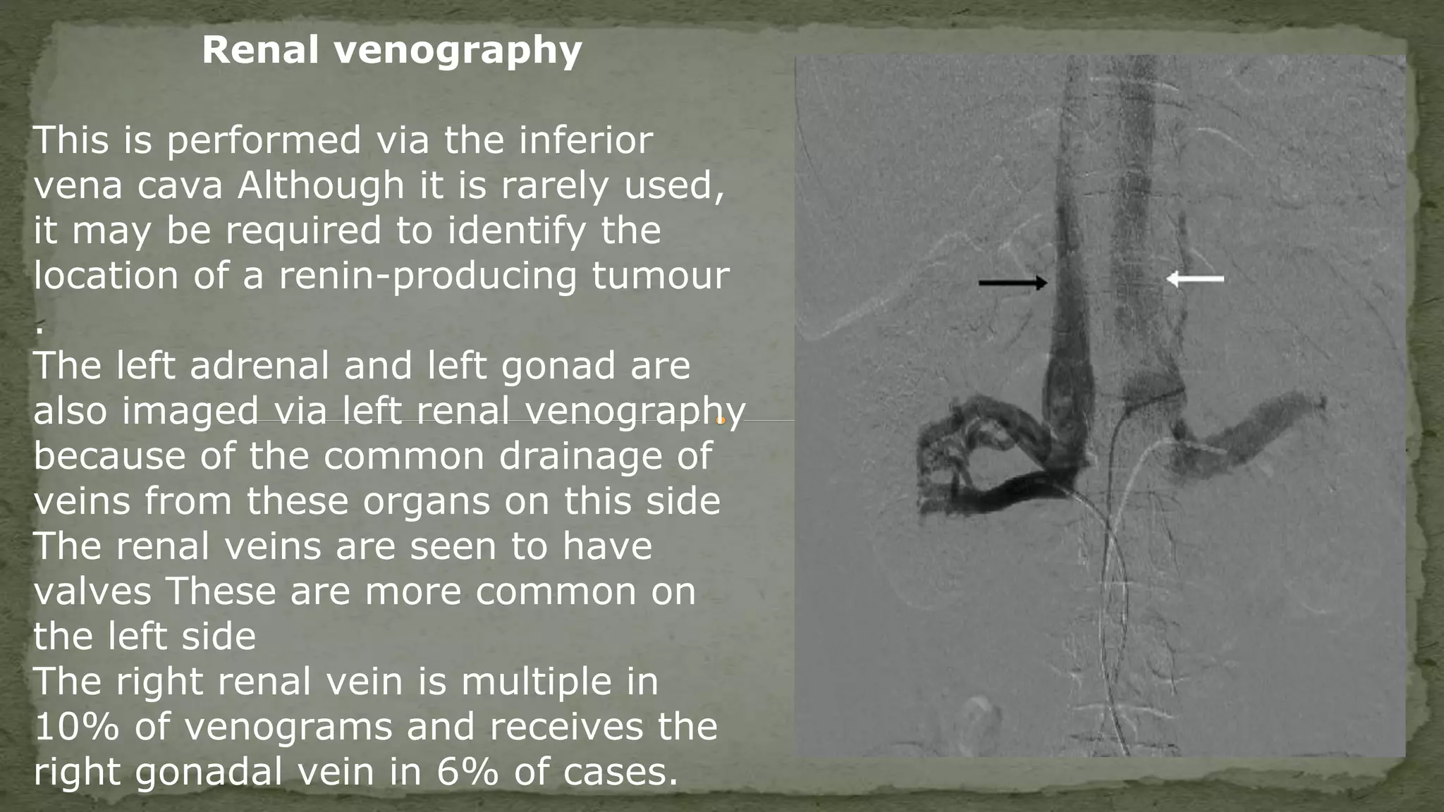 anatomy urinary system.pptx