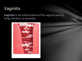 female reproductive organ: Vagina | PPTX
