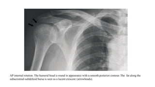Anatomy and xrays of shoulder joint | PPTX