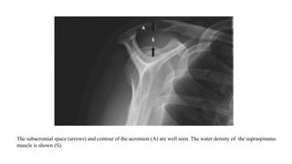 Anatomy and xrays of shoulder joint | PPTX