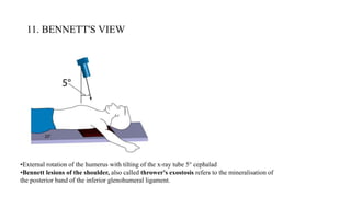 Anatomy and xrays of shoulder joint | PPTX