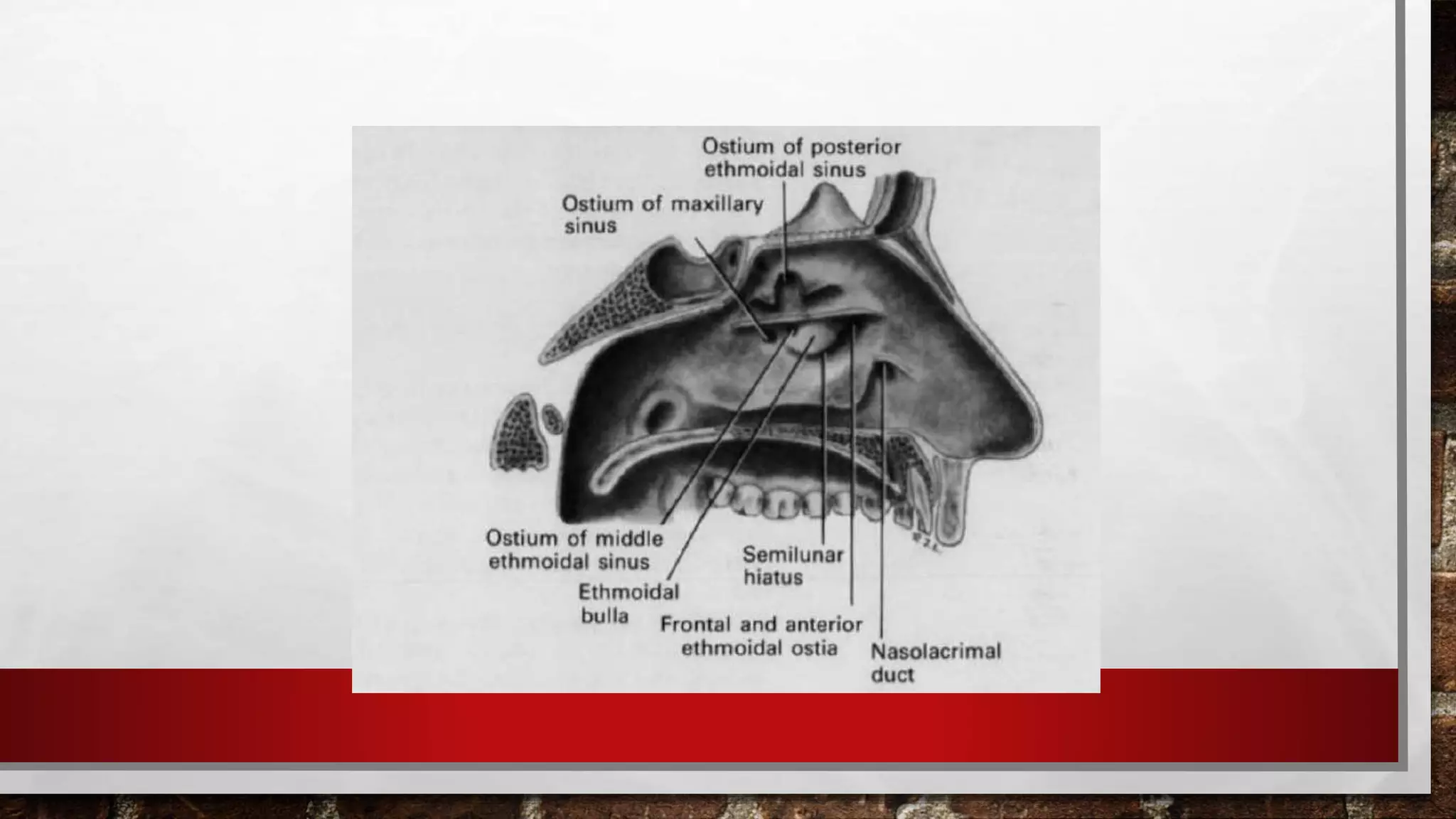 Anatomy of the nose and paranasal sinuses made easy | PPTX