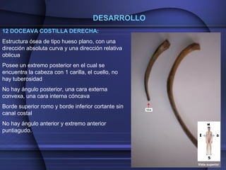 REDUCCIÓN ESQUELÉTICA DEL HEMITORAX DERECHO | PPT