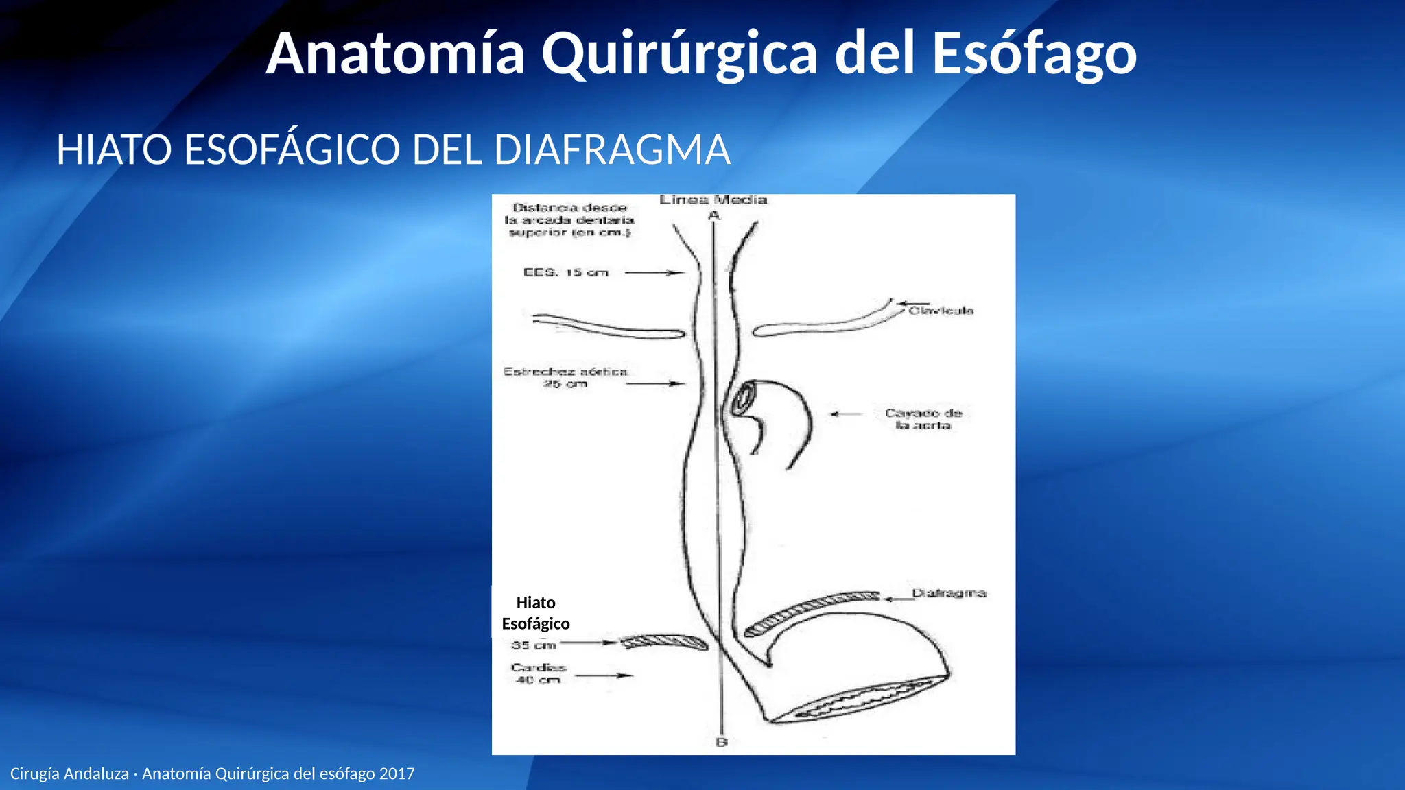 anatomia quirurgica y fisioligia de esofago.pptx