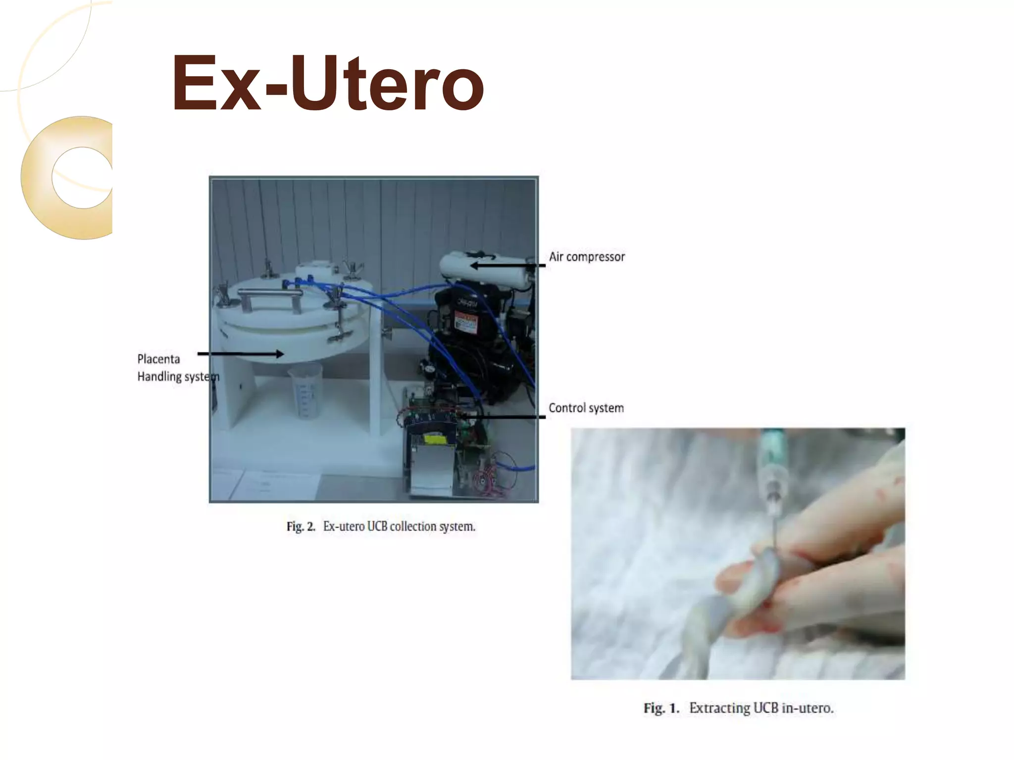 AN AUTO-PERFUSING UMBILICAL CORD BLOOD COLLECTION INSTRUMENT.ppt