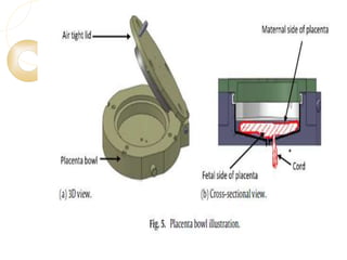 AN AUTO-PERFUSING UMBILICAL CORD BLOOD COLLECTION INSTRUMENT.ppt