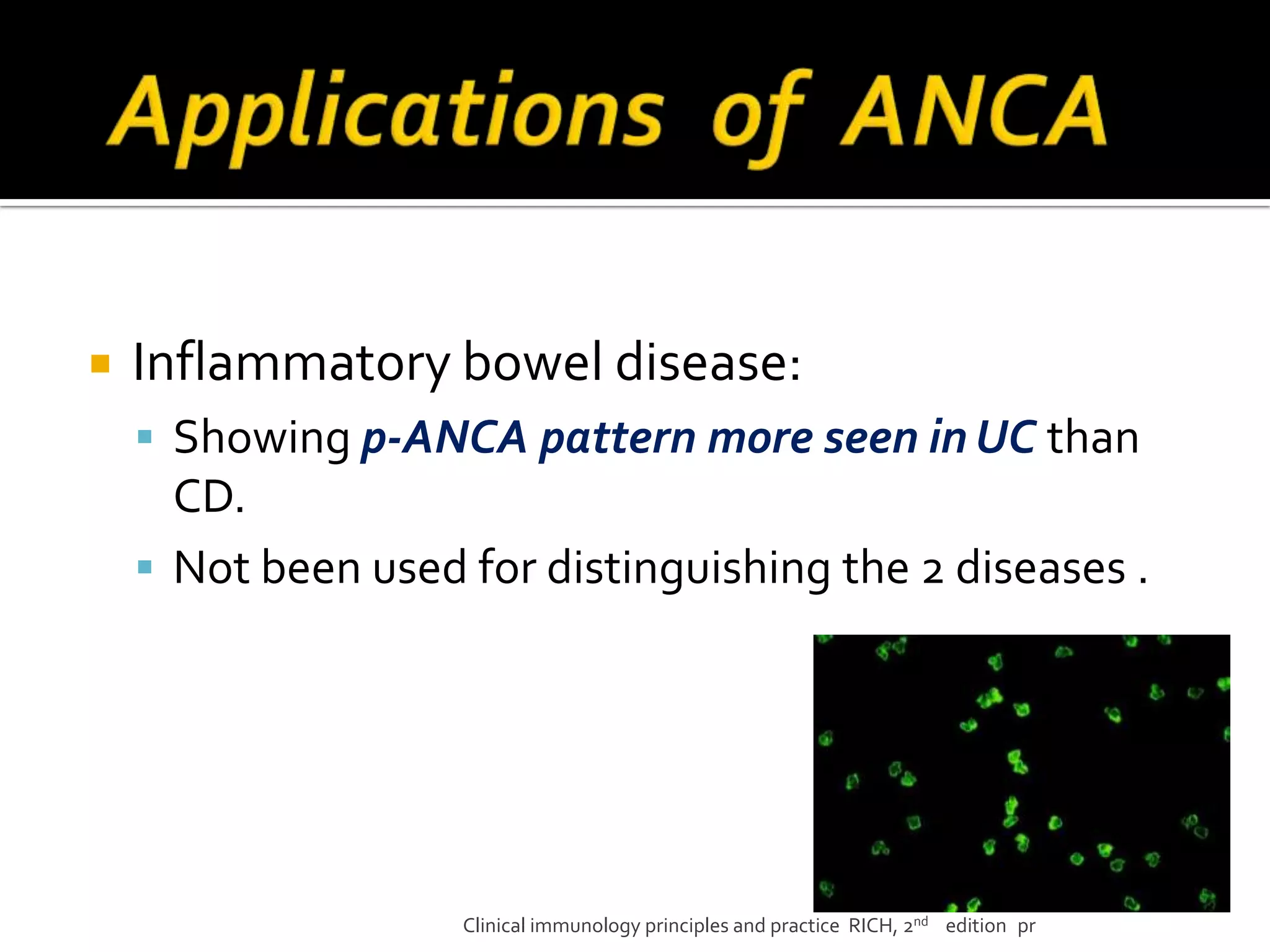 ANCA | PPTX