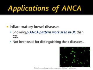 ANCA | PPTX