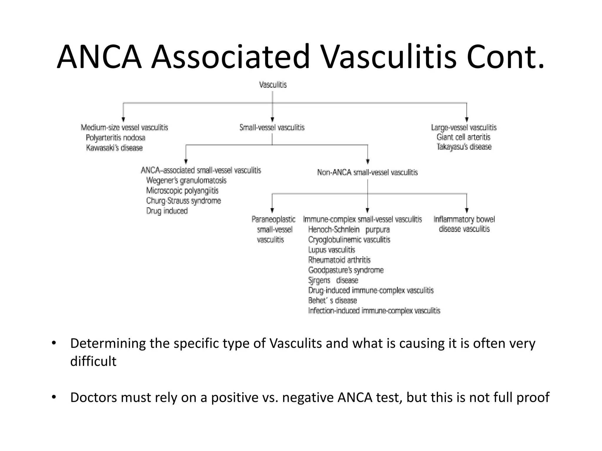 Genetically Distinct differences of ANCA-Associated Vasculitis Disorders | PPTX