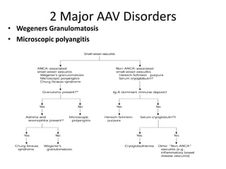 Genetically Distinct differences of ANCA-Associated Vasculitis ...