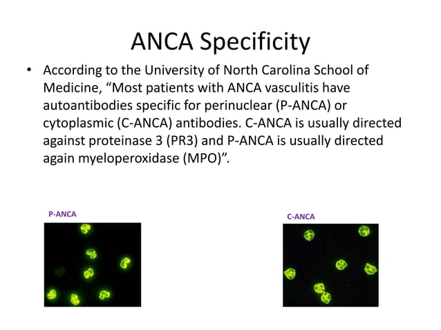 Genetically Distinct differences of ANCA-Associated Vasculitis Disorders | PPTX