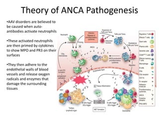 Genetically Distinct differences of ANCA-Associated Vasculitis ...
