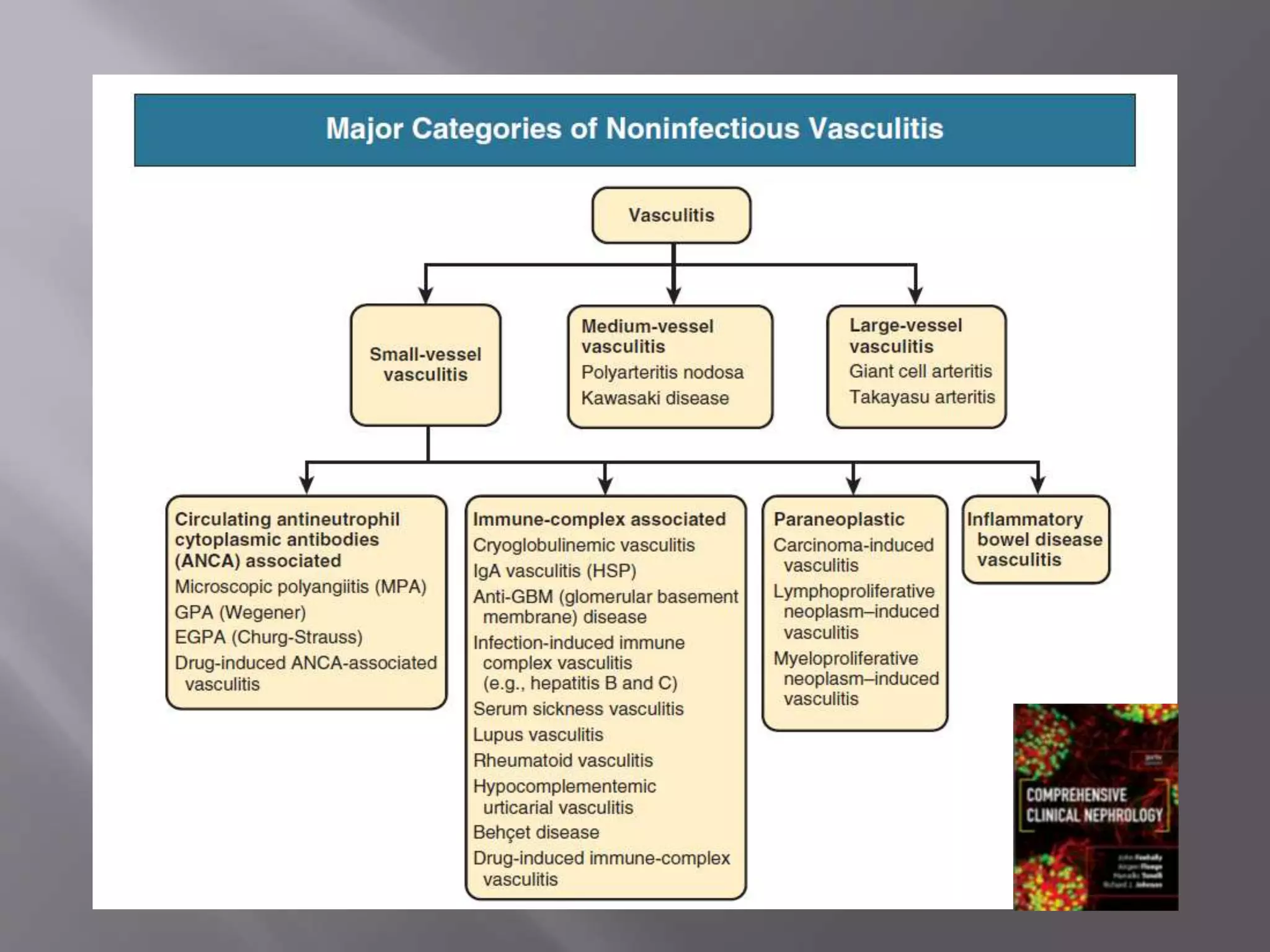 ANCA vasculitis and Renal Diseases | PPTX