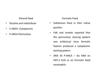 Anca testing in small vessel vasculitis | PPT