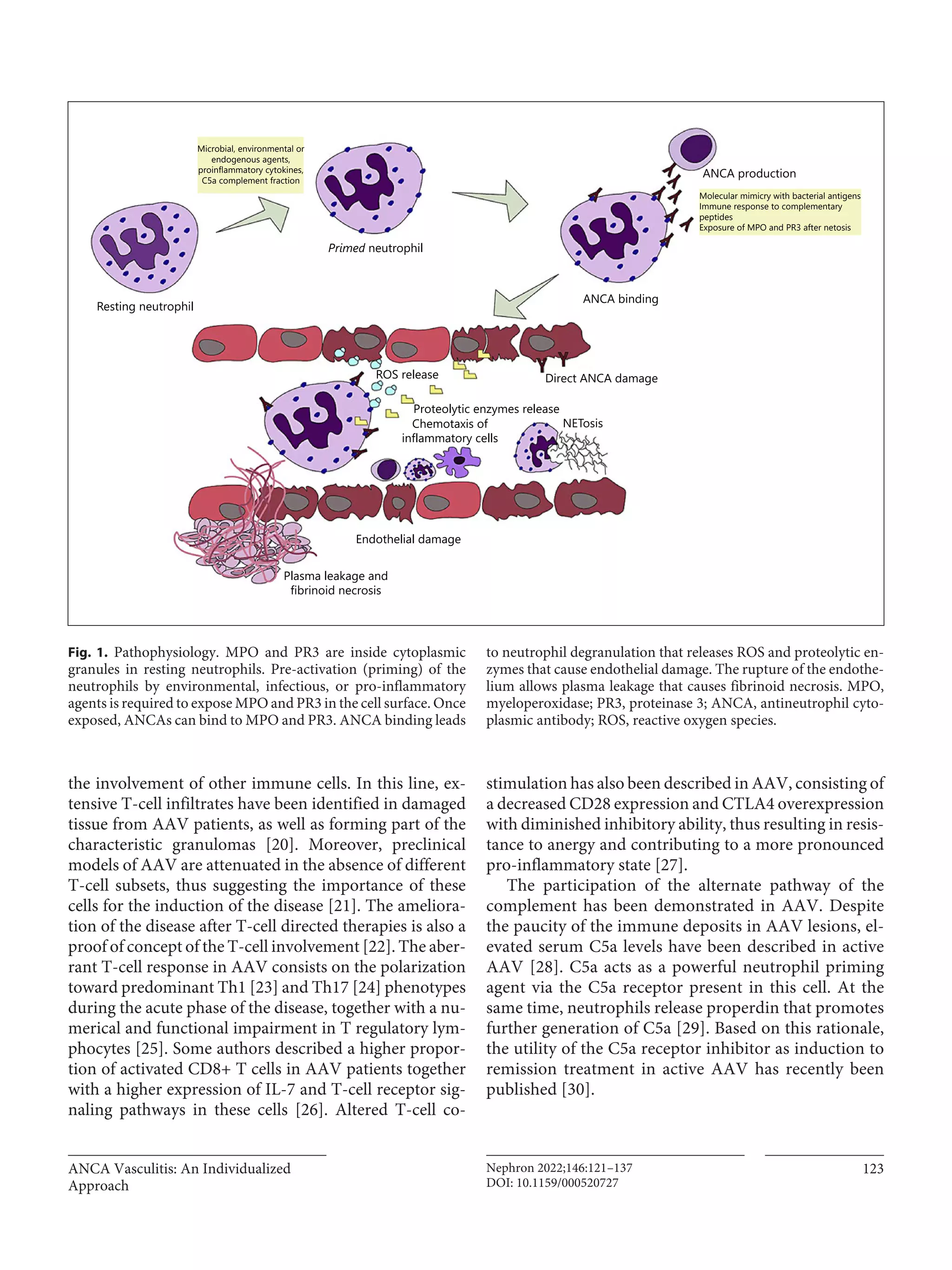anca vasculitis.pdf