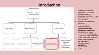anca vasculitis in pediaric pts .pptx