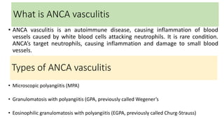 ANCA Vasculitis (2).pptx