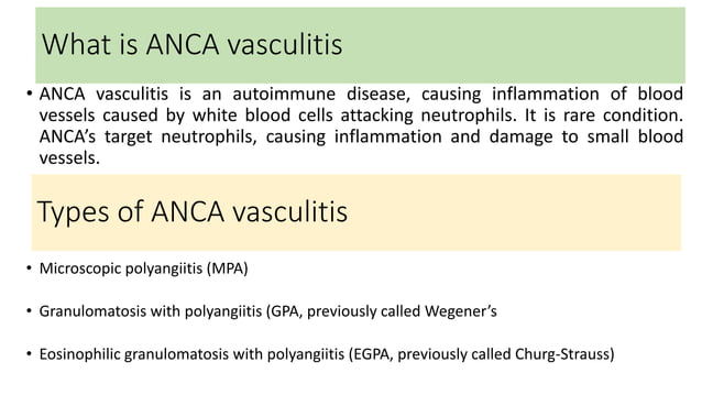ANCA Vasculitis (2).pptx