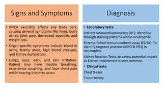 ANCA Vasculitis (2).pptx